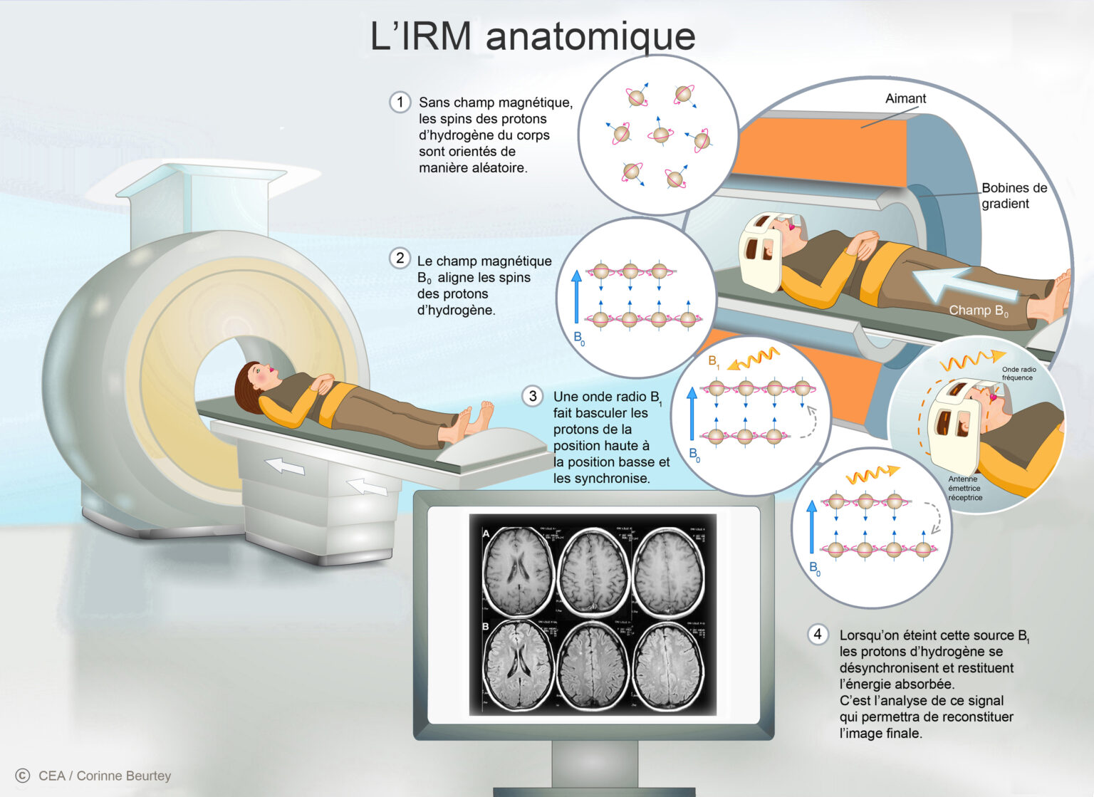 Principes de l’IRM, IRMf, IRM de diffusion et TEP : - Vieterre