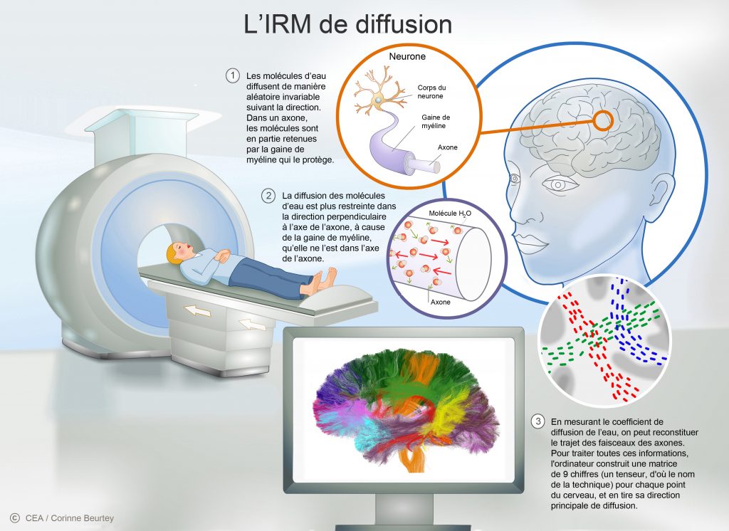 Principes de l’IRM, IRMf, IRM de diffusion et TEP : - Vieterre