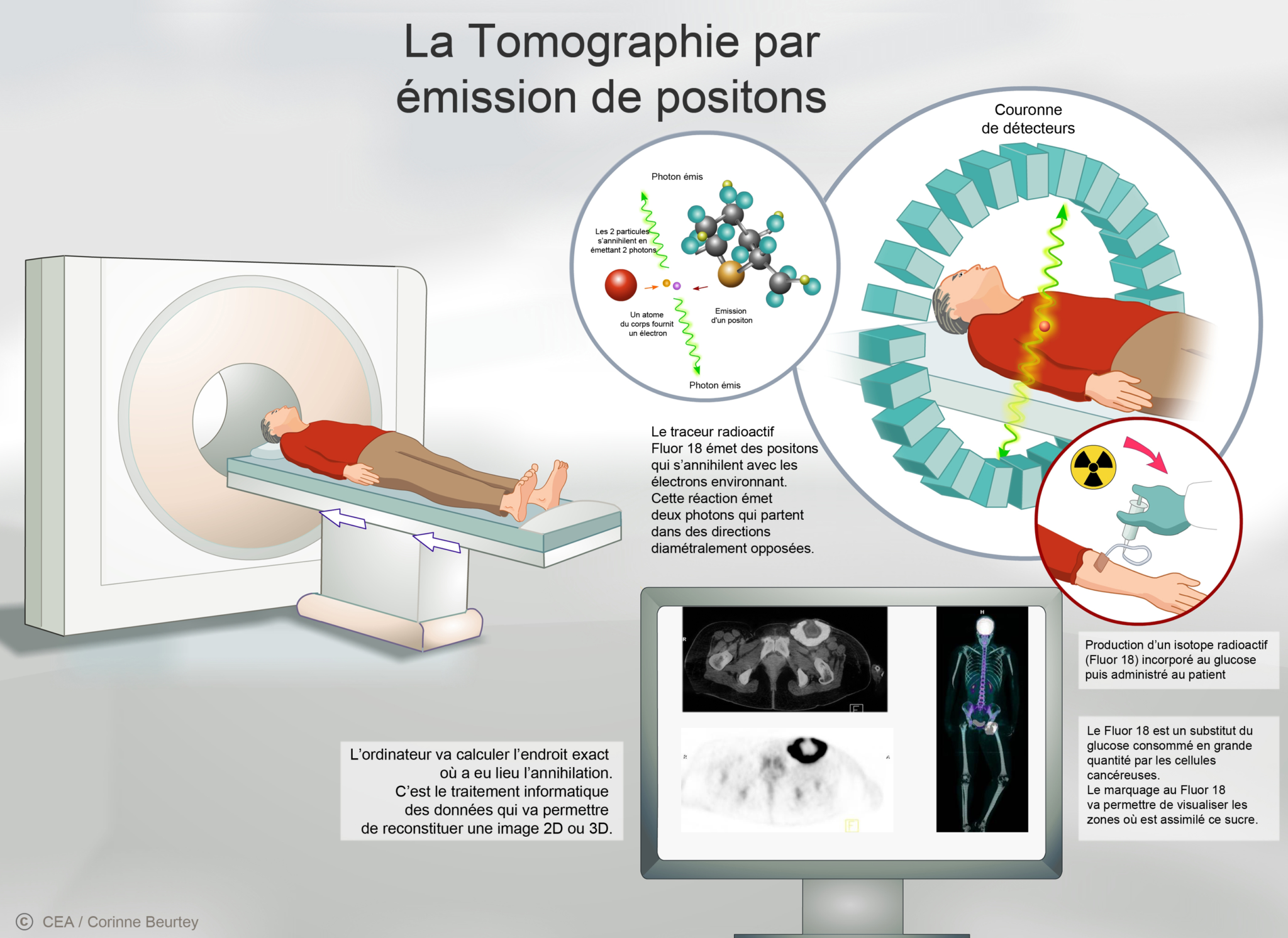 Principes De L IRM IRMf IRM De Diffusion Et TEP Vieterre