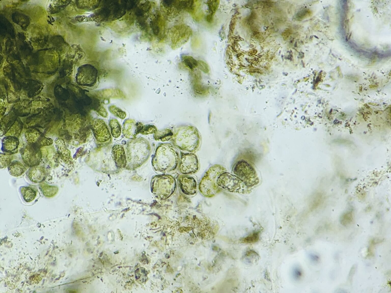 Obtenir des protoplastes de poireau ou d'élodée -SVT